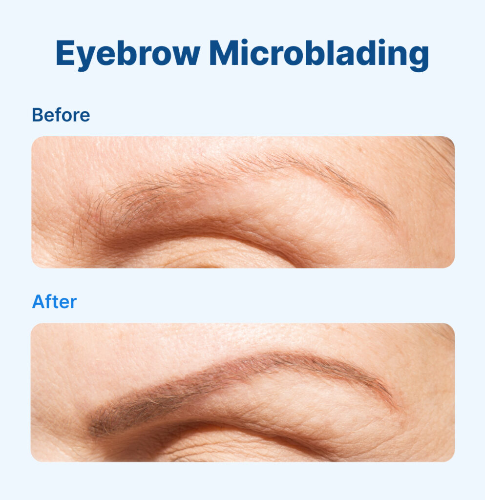 Microblading 2025: Benefits, Cost, and Its Alternatives